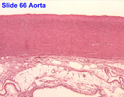 Aorta Slide Labeled